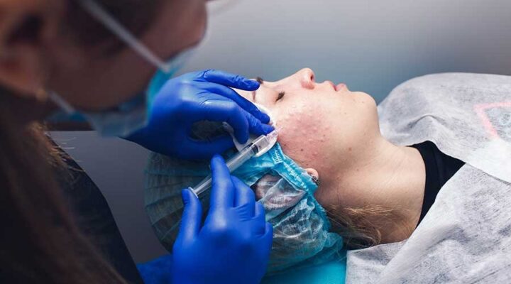 Công nghệ Mesotherapy và ưu điểm trong làm đẹp da | Mediworld