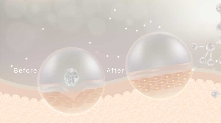 Acetyl Hexapeptide 8 (AH8) - Thành phần hạn chế lão hóa da vượt trội ...